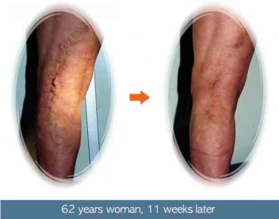 Before & After Gallery | Evita Clinic’s Real Patient Results in Korea