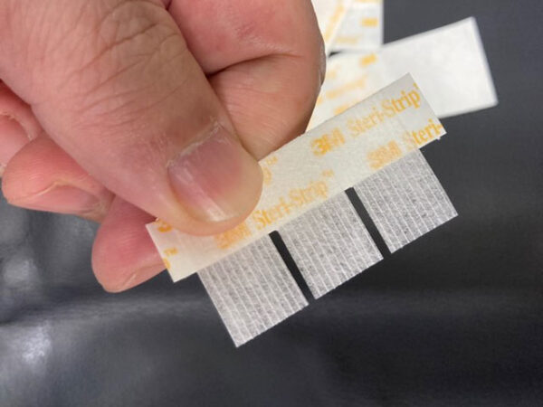 Evita Clinic Steri-Strips After Gynecomastia Surgery: Optimal Healing